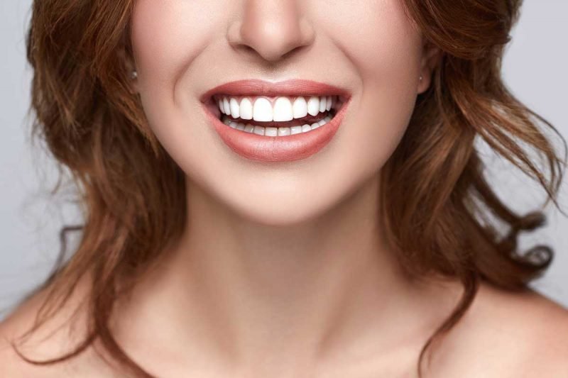 6 Surprising Benefits of Straight Teeth